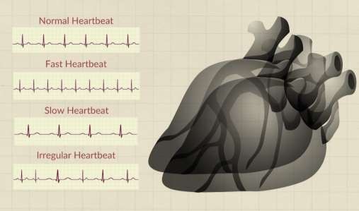 What generates cardiac rhythm? · Get a professor